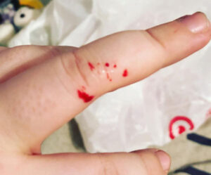 Do Corn Snakes Bite: A Guide To Why They Bite, Prevention And Cure